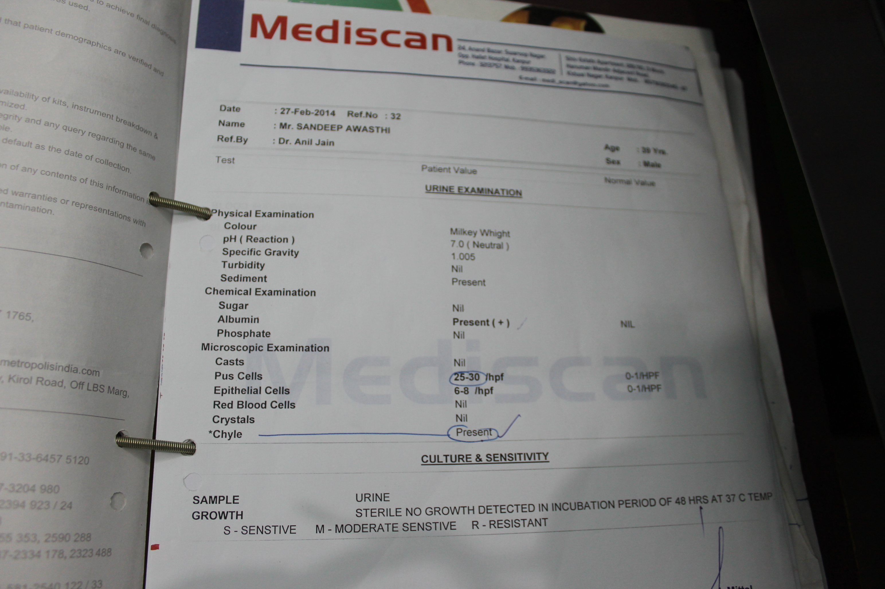 Chyluria patient cured in a year without any recurrence | Case Study