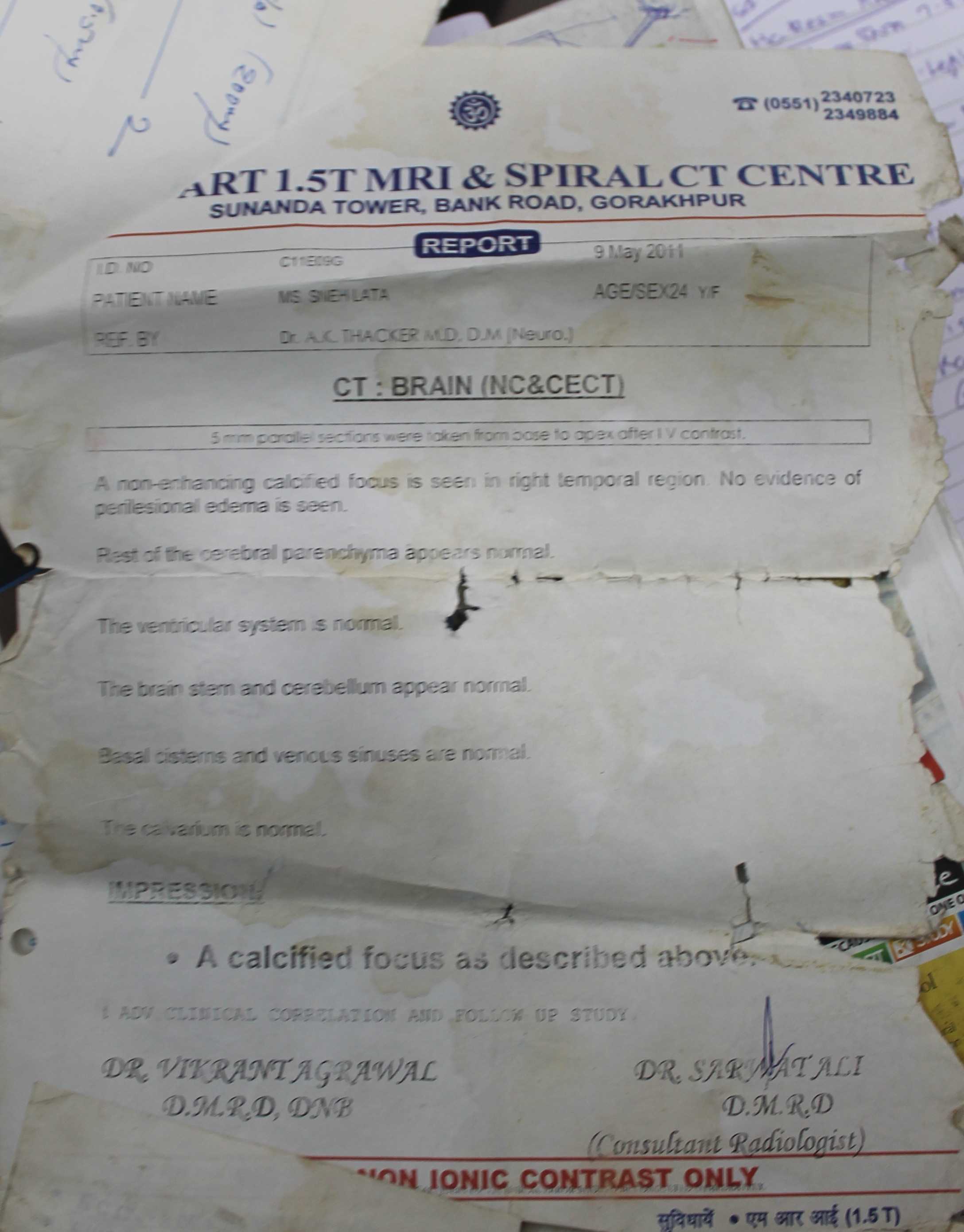 9 years old Epilepsy problem completely cured in 2 years | Case Study