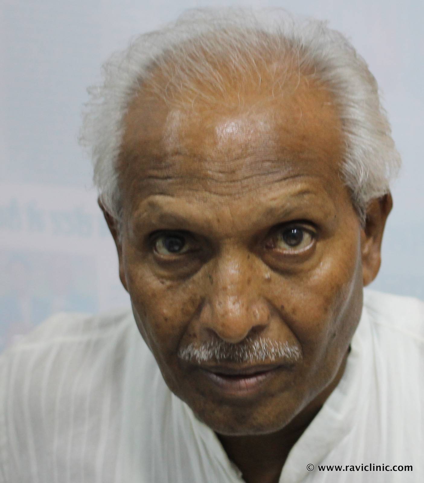 9 MM Ureteric Stone Discharged in Just one week | Case Study