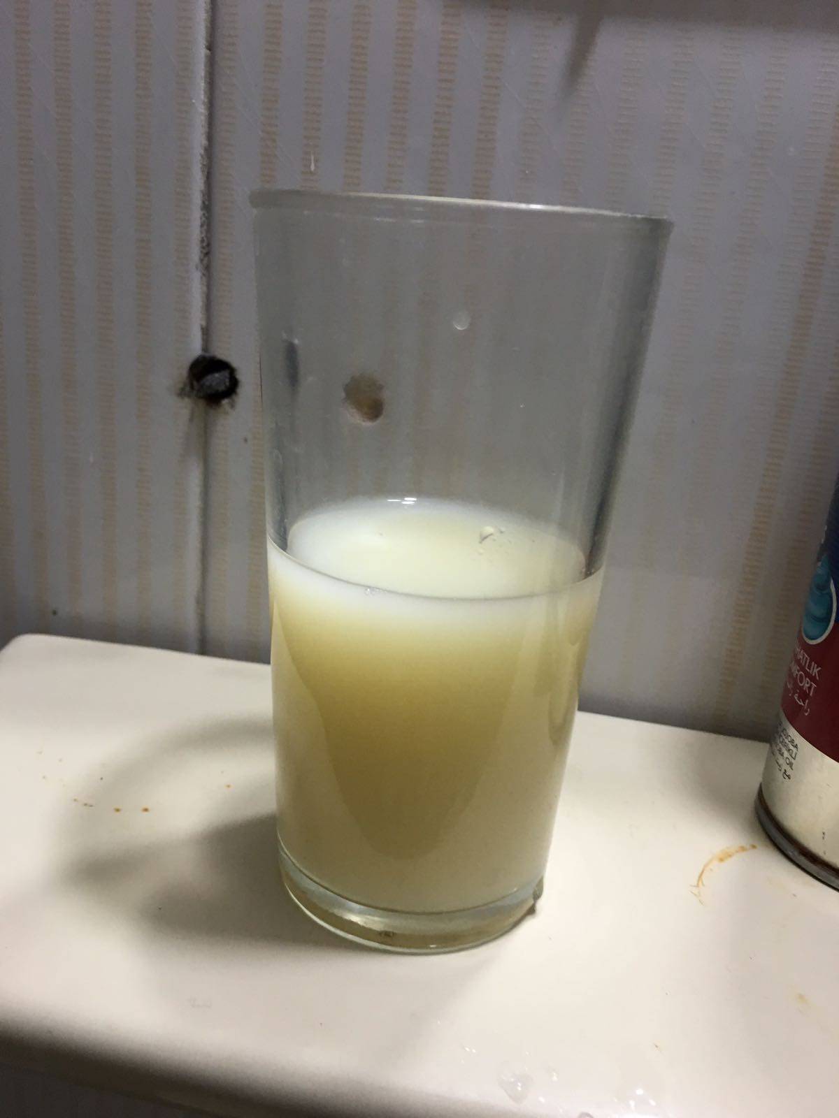 Chyluria for 4 years case from Kuwait getting cured in 15 days with ...