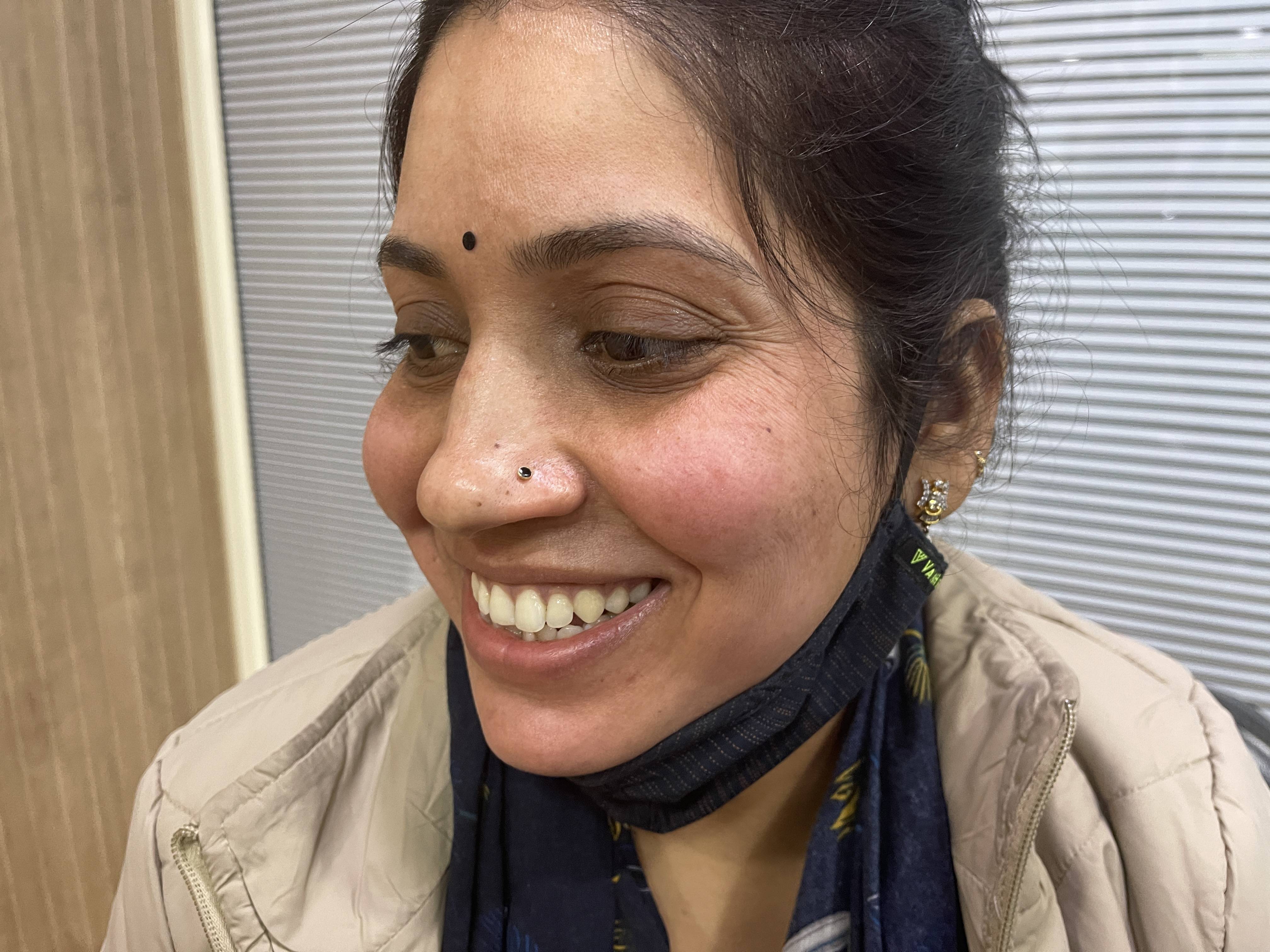 A case of Rosacea , sinusitis and Asthma recovered with Homeopathy ...