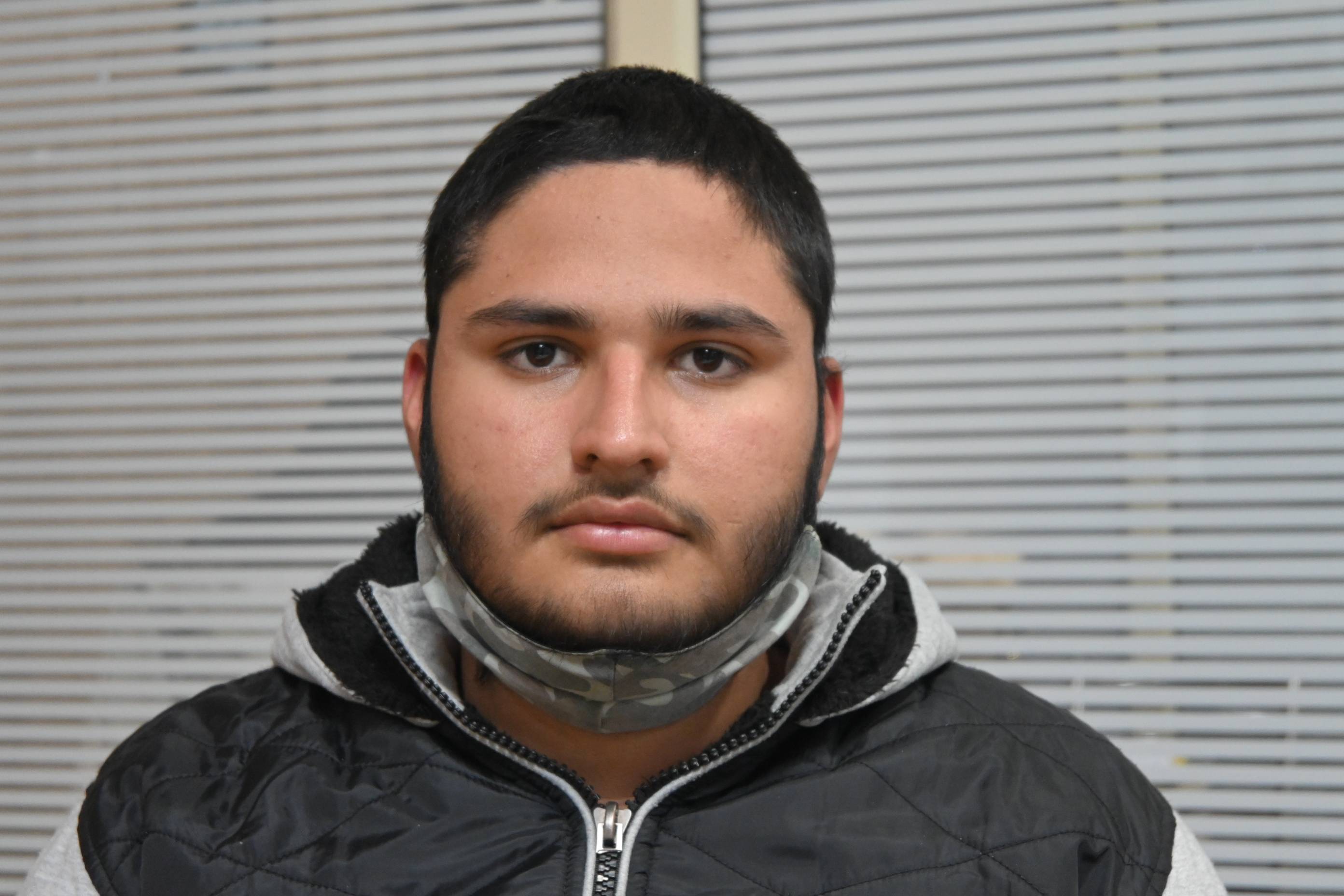 Seborrhoeic Dermatitis Since 4 years and Hyperhidrosis Cure | Case Study