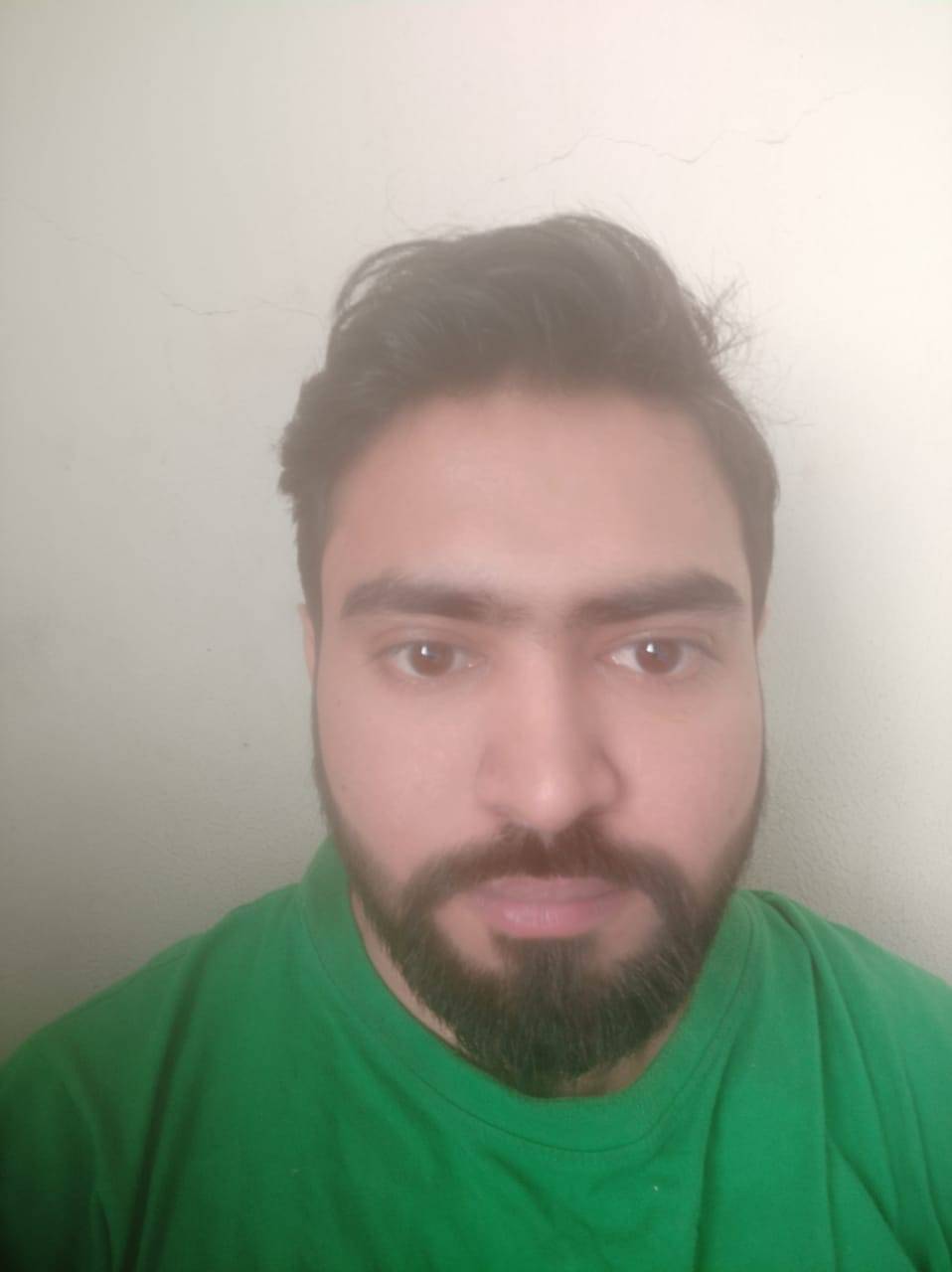 rosacea-for-5-years-getting-cured-in-online-patient-from-pune-case-study