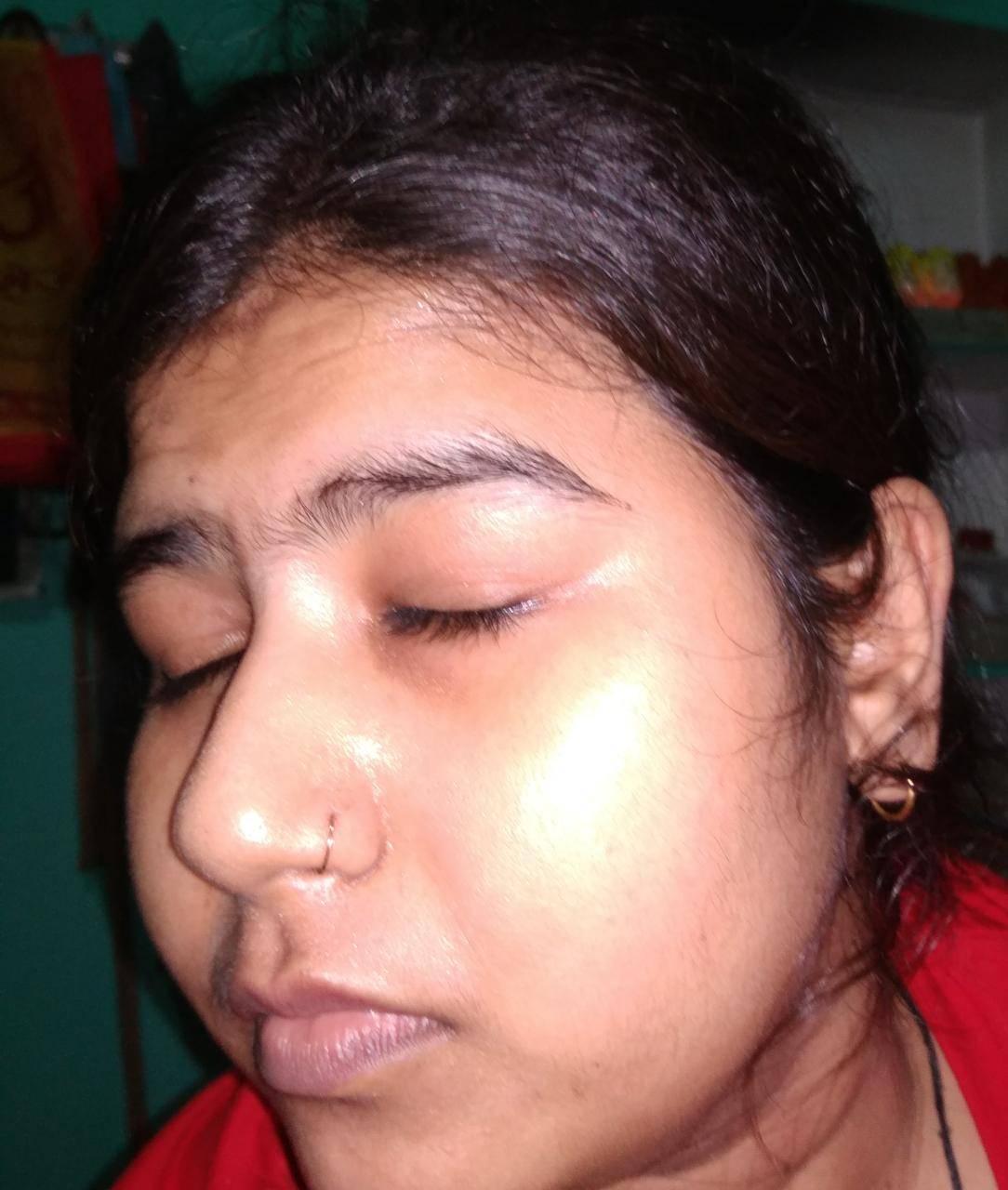 Large bumps at face Molluscum Contagiosum for 7 Months got cured in a ...