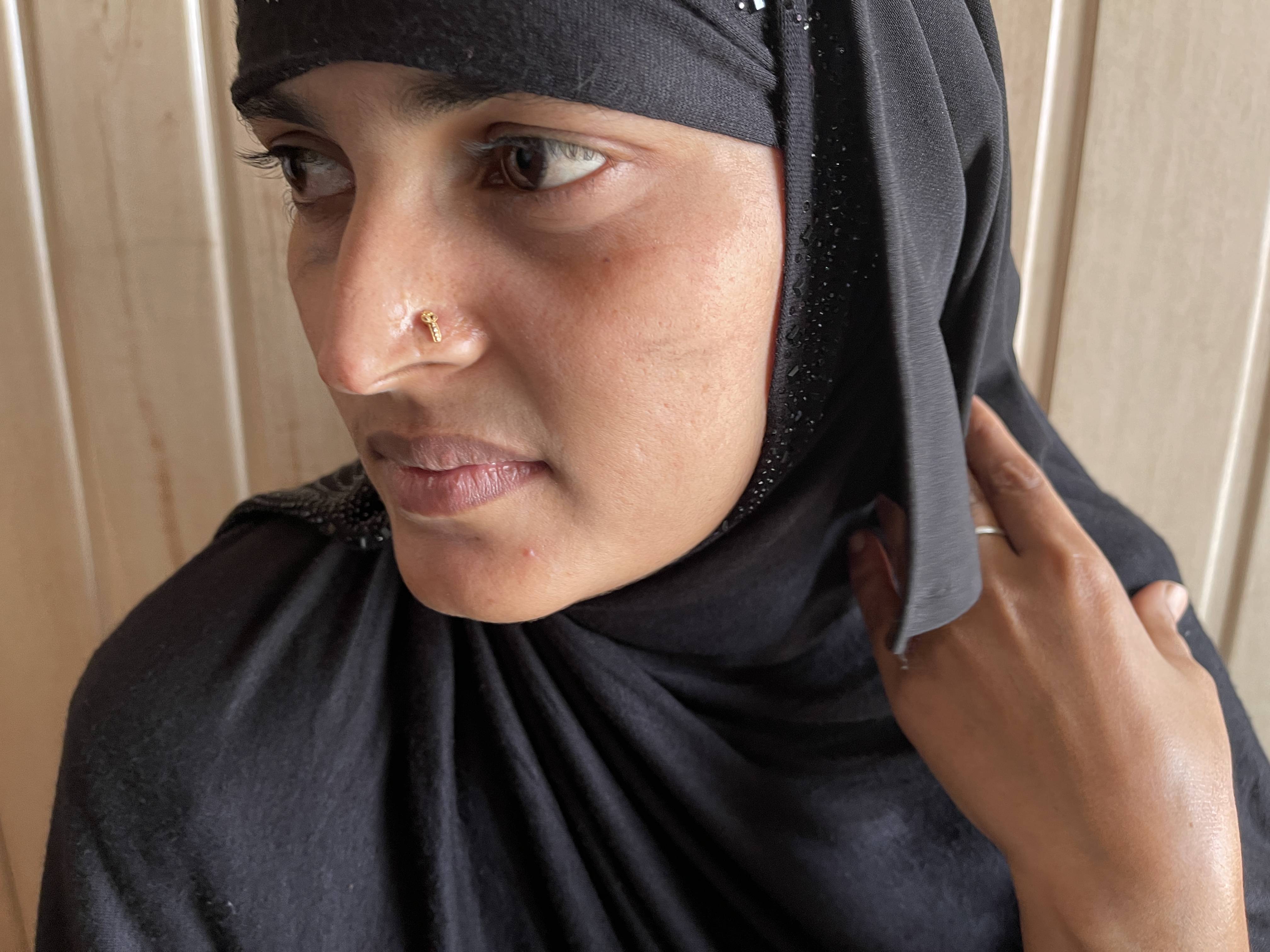 Chronic Hyper hydrosis (Sweat Problem) from last 2 - 3 years & Wart ...