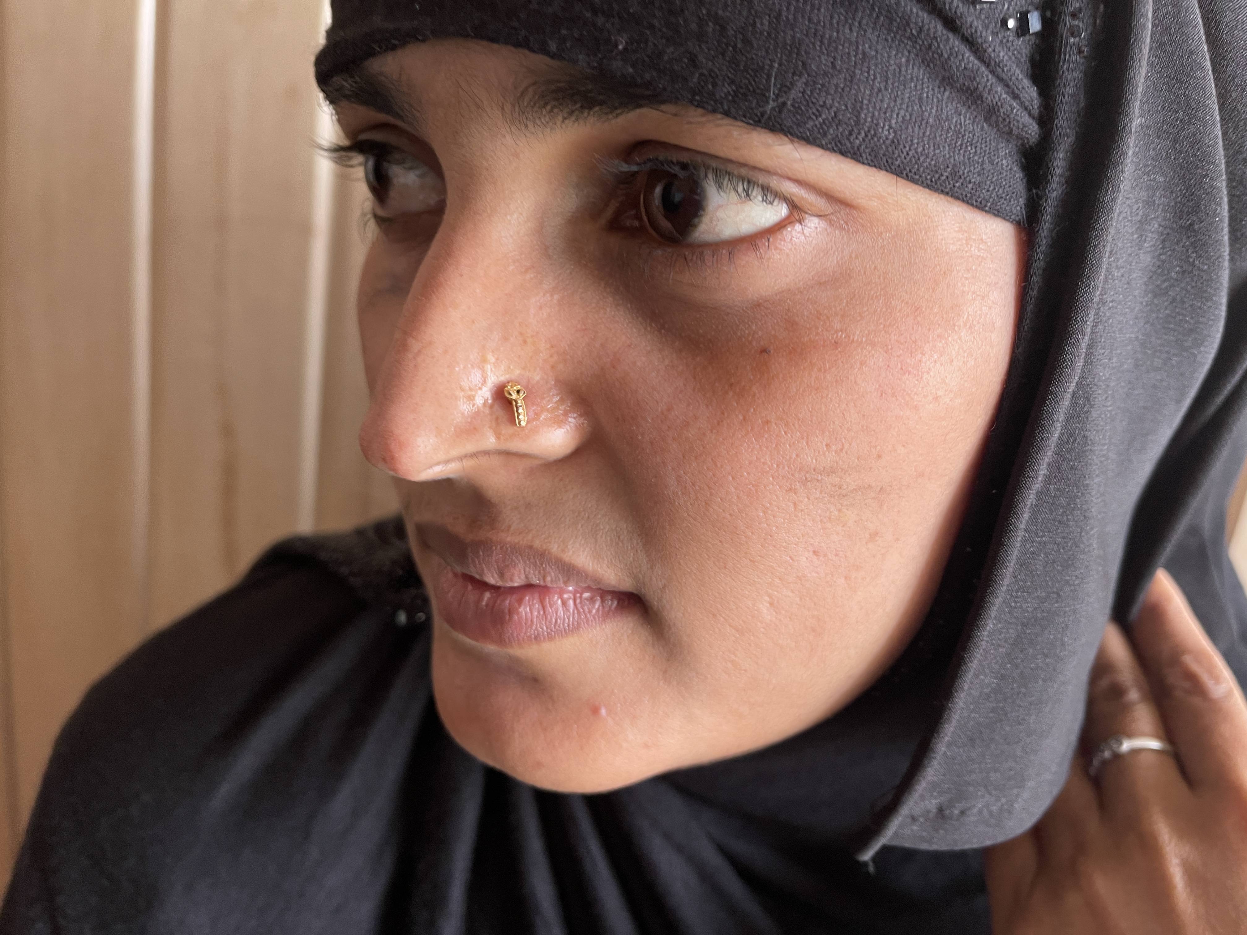 Chronic Hyper hydrosis (Sweat Problem) from last 2 - 3 years & Wart ...